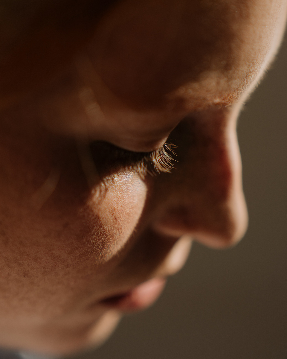 Hyperpigmentierung – Alles über Pigmentflecken und wie Du sie loswirst │ mit BABOR