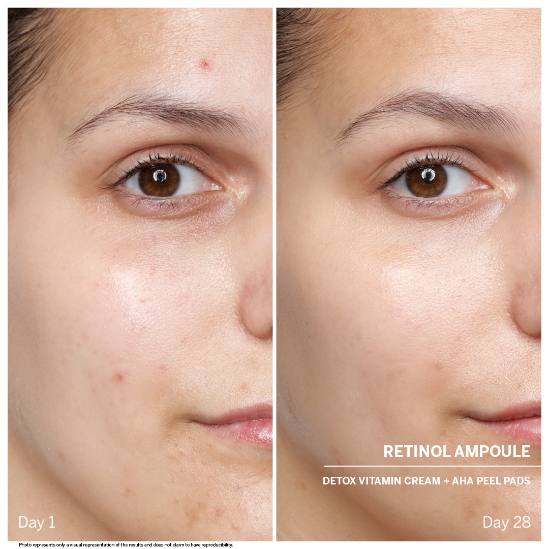 Retinol | Wirkung & Anwendung auf der Haut